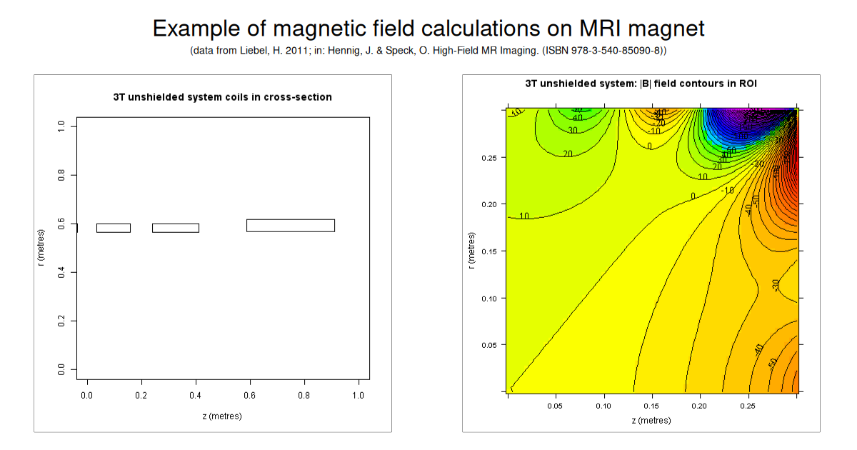 Unshielded 3T MRI magnet system